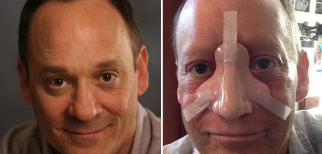 Steve Bean, ator e comediante norte-americano de séries